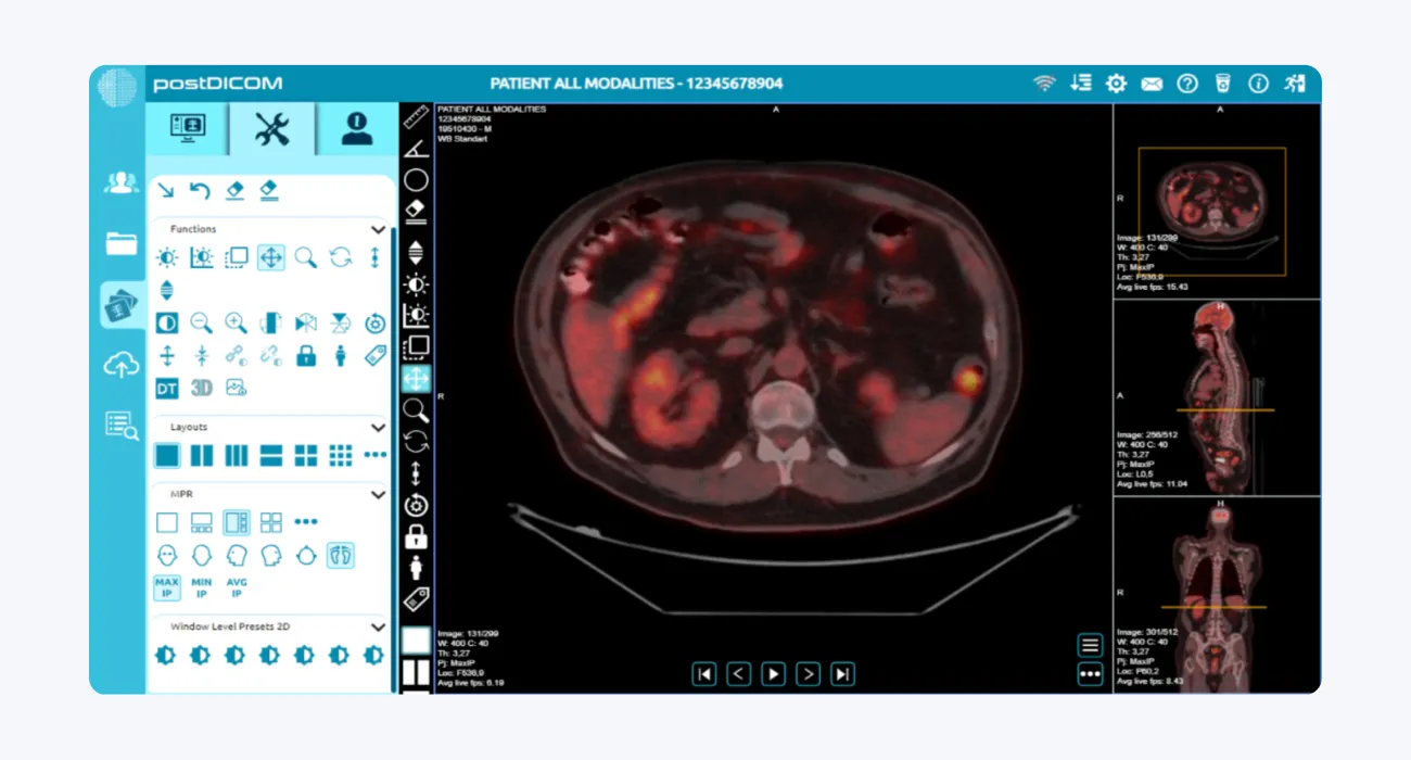10 Best DICOM Viewers for Medical Images (2023 Update)